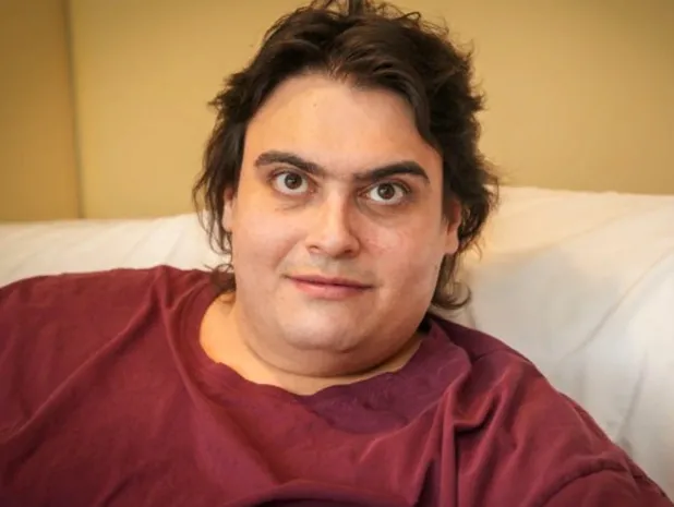 Jason Holton, el hombre más pesado de Inglaterra ha muerto a los 33 ...